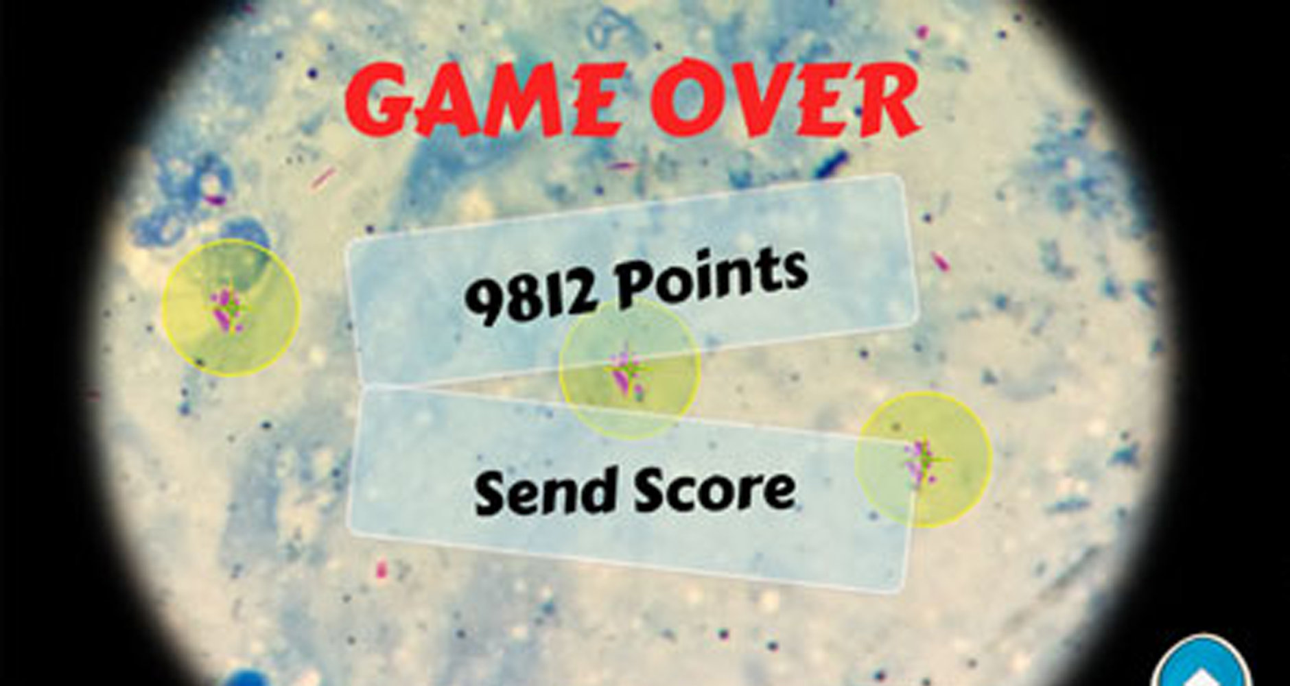 A Game for Detecting Tuberculosis