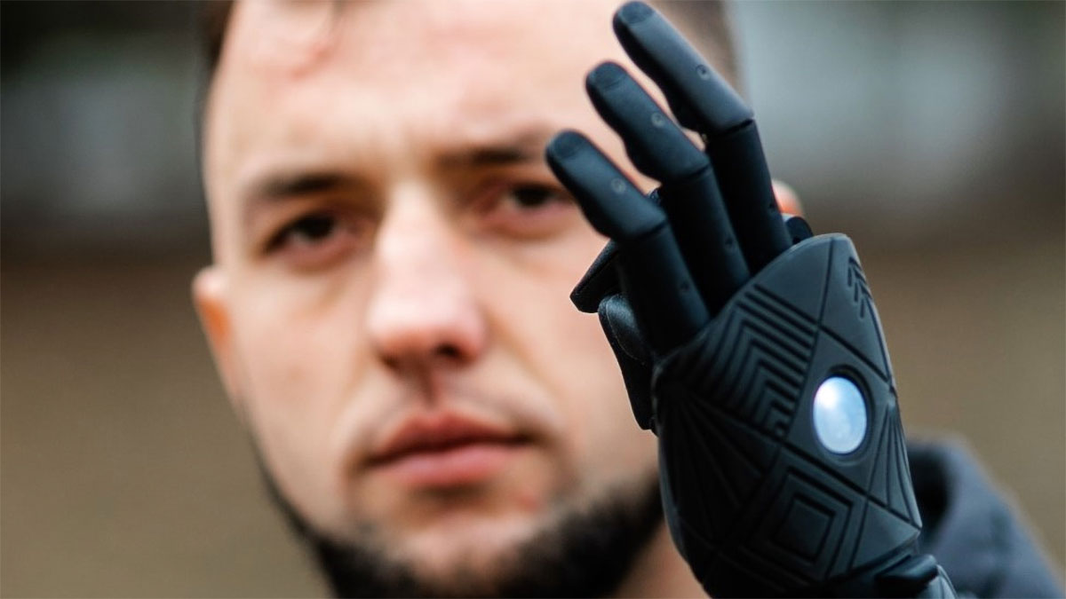 Bionic Arms For Ukrainian Soldiers